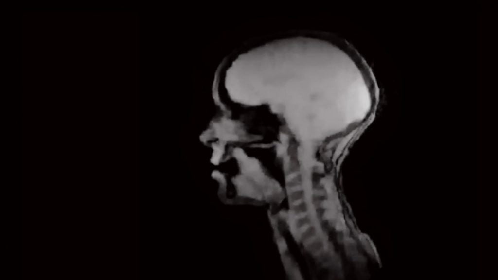 What Happens When You Sing During An MRI? This! - That Eric Alper